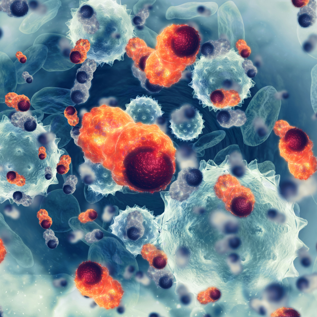 Ressources sur le dépistage du cancer disponibles en plusieurs langues ...